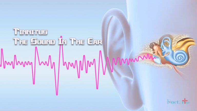 Tinnitus: The Sound in the Ear - Types and Causes - DoctorinBD.com